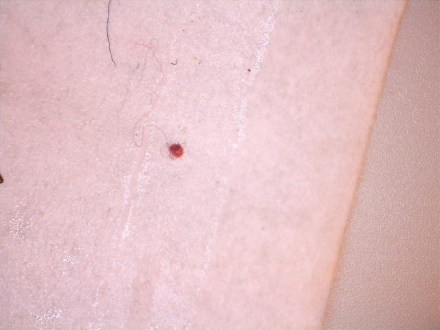 Invisible flying biting bugs